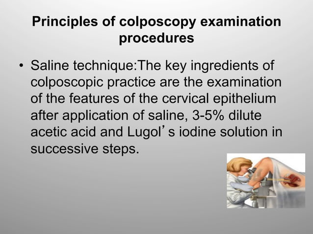 Colposcopy nstrumentation and principles on how to do 22 | PDF