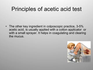 Colposcopy nstrumentation and principles on how to do 22 | PDF