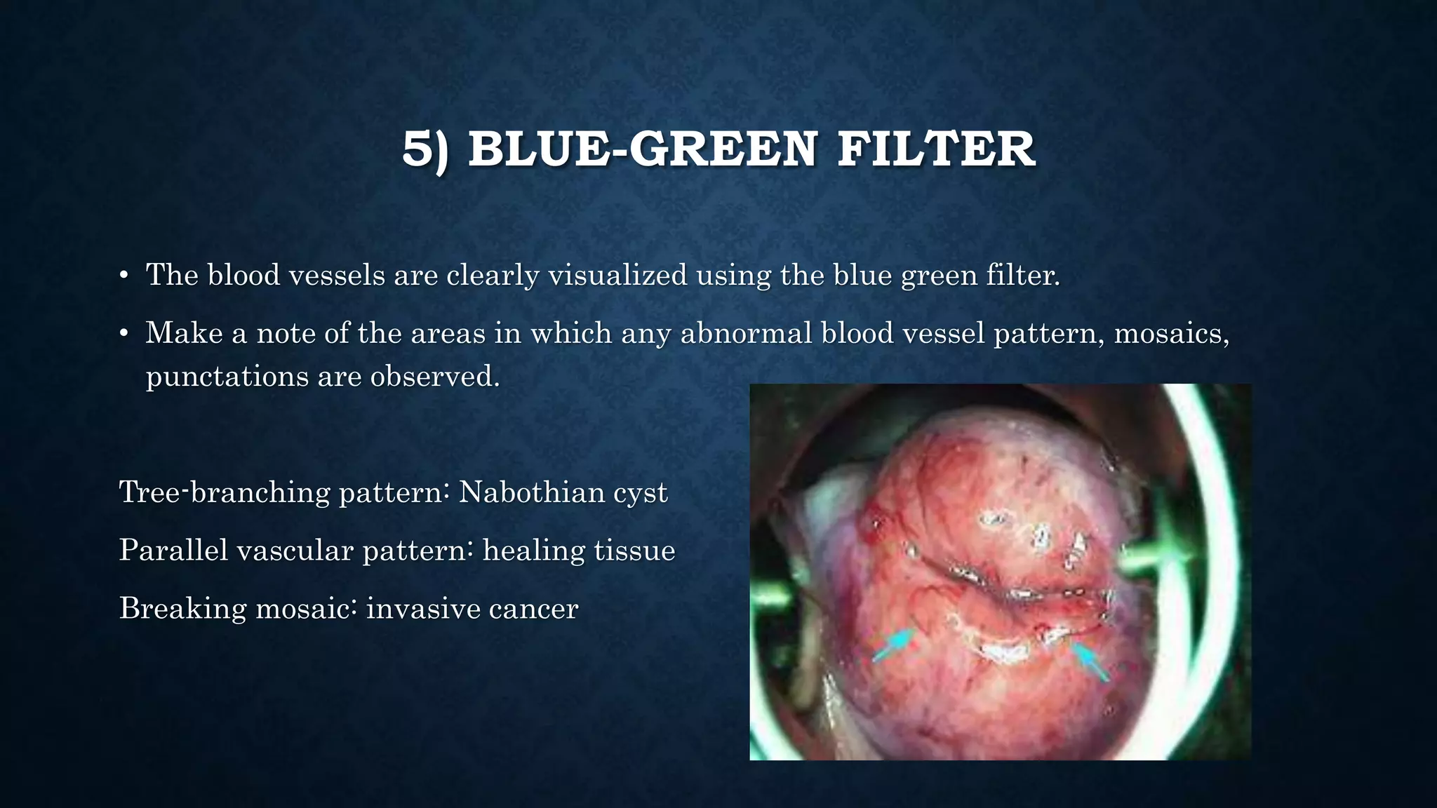 COLPOSCOPY.pptx