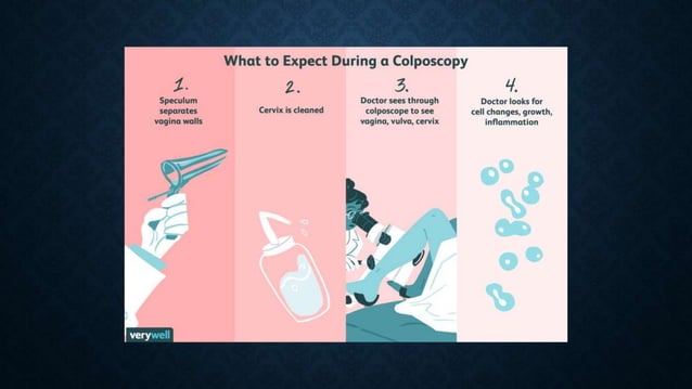 COLPOSCOPY.pptx