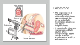 Colposcopy.pptx