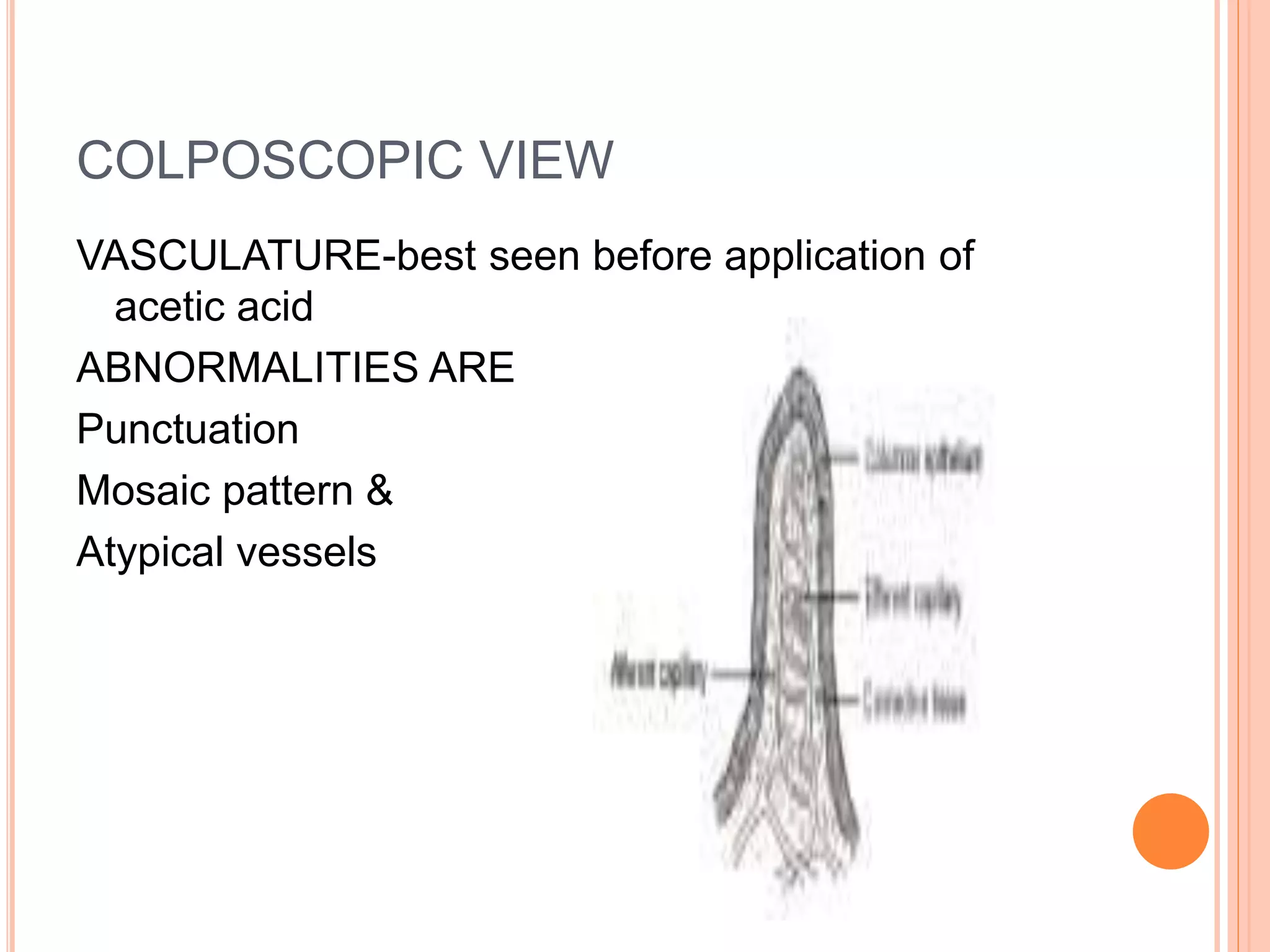 Colposcopy examination | PPTX