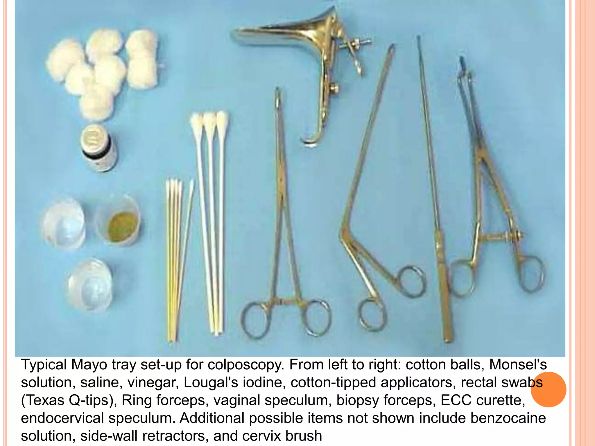 Colposcopy examination | PPTX