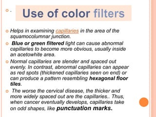 Colposcopy examination | PPTX