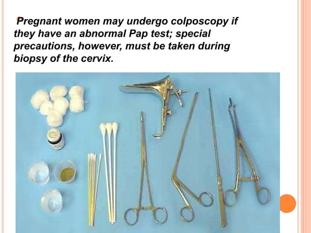 Colposcopy examination | PPTX