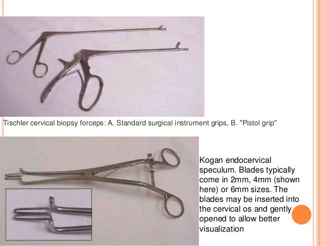 Colposcopy examination