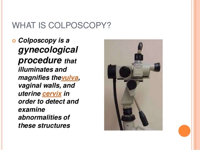 Colposcopy examination