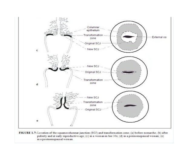 Colposcopy2 1
