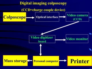 colposcopy | PPT