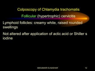 Colposcopy of cevicovaginitis | PDF