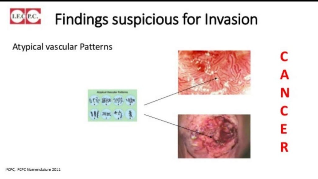 Colposcopy technique