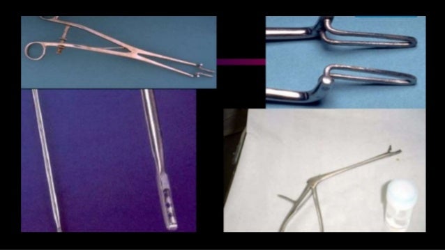 Colposcopy technique