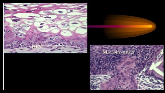 Colposcopy technique