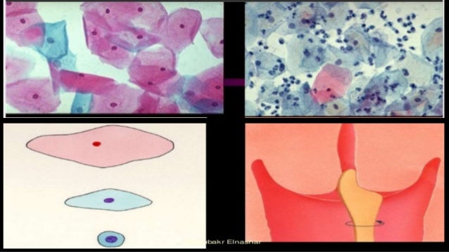 Colposcopy technique