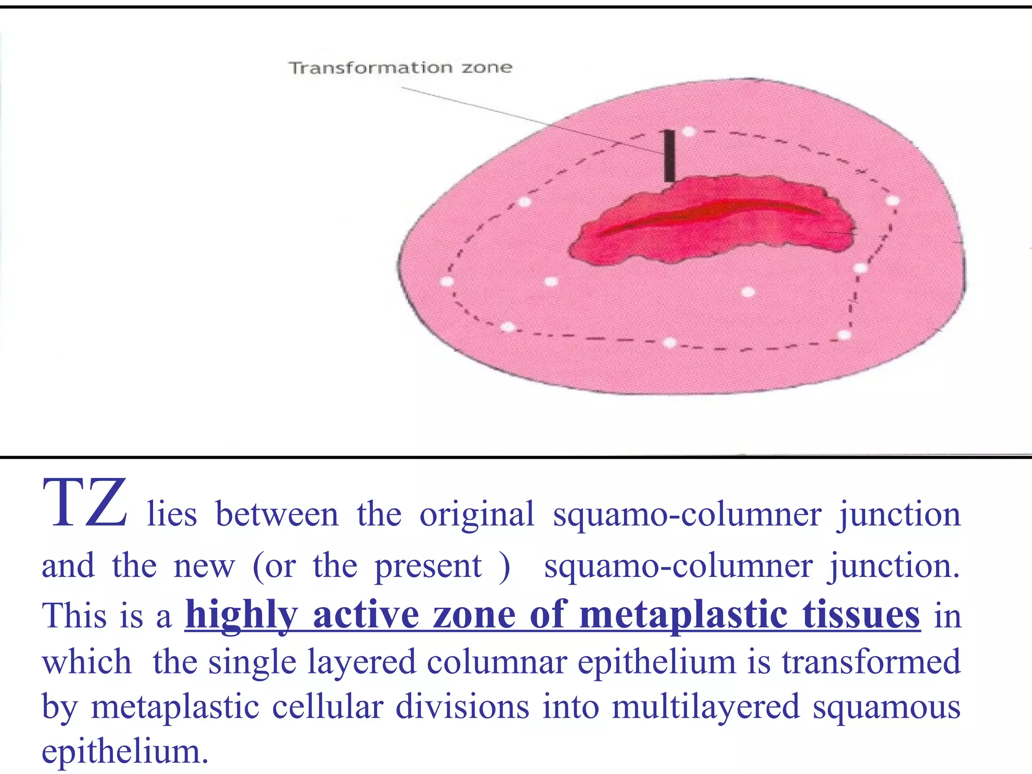Colposcopy training part 1 ,DR. SHARDA JAIN Dr. Jyoti Agarwal / Dr ...