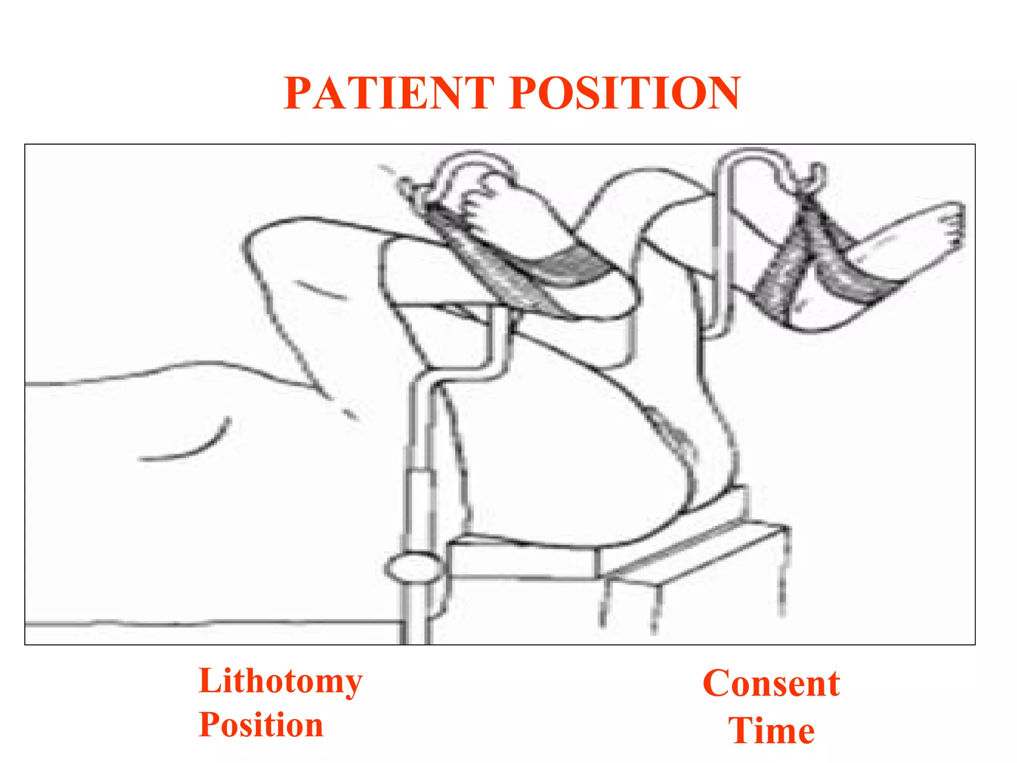 Colposcopy training part 1 ,DR. SHARDA JAIN Dr. Jyoti Agarwal / Dr ...