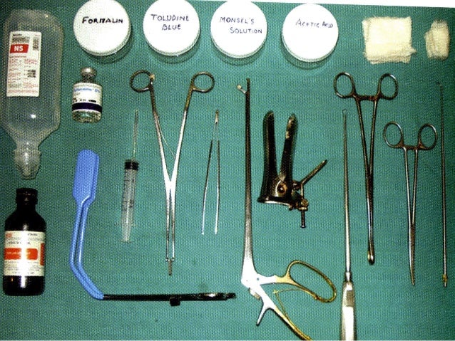 Colposcopy Today Practical Approach !! Dr. Sharda Jain , Dr. Jyoti Ag…