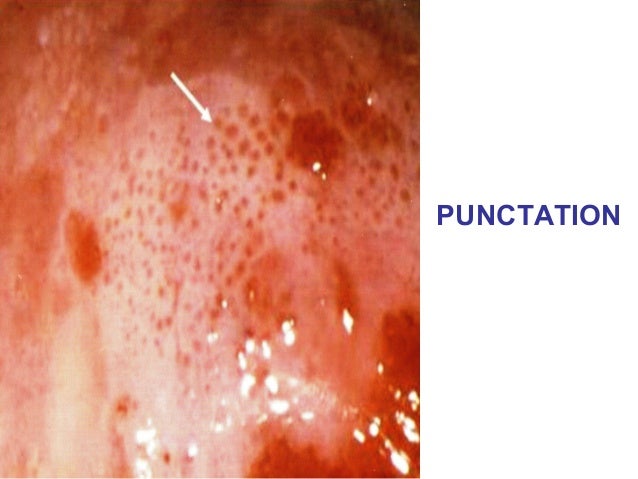 Colposcopy Today Practical Approach !! Dr. Sharda Jain , Dr. Jyoti Ag…