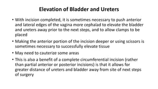 Vaginal Hysterectomy Anterior and Posterior Colpotomies | PPTX