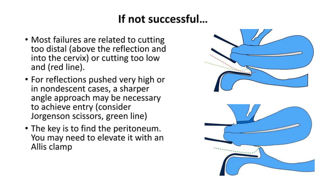Vaginal Hysterectomy Anterior and Posterior Colpotomies | PPT
