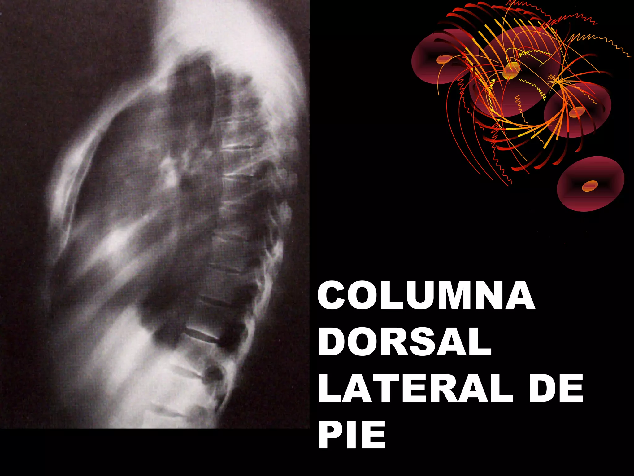 Columna Dorsal y Lumbar | PPT
