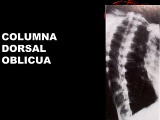 Columna Dorsal y Lumbar | PPT