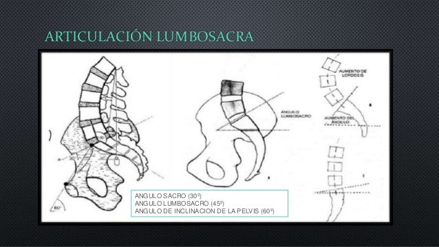 Columna lumbar expo