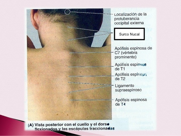 Columna vertebral