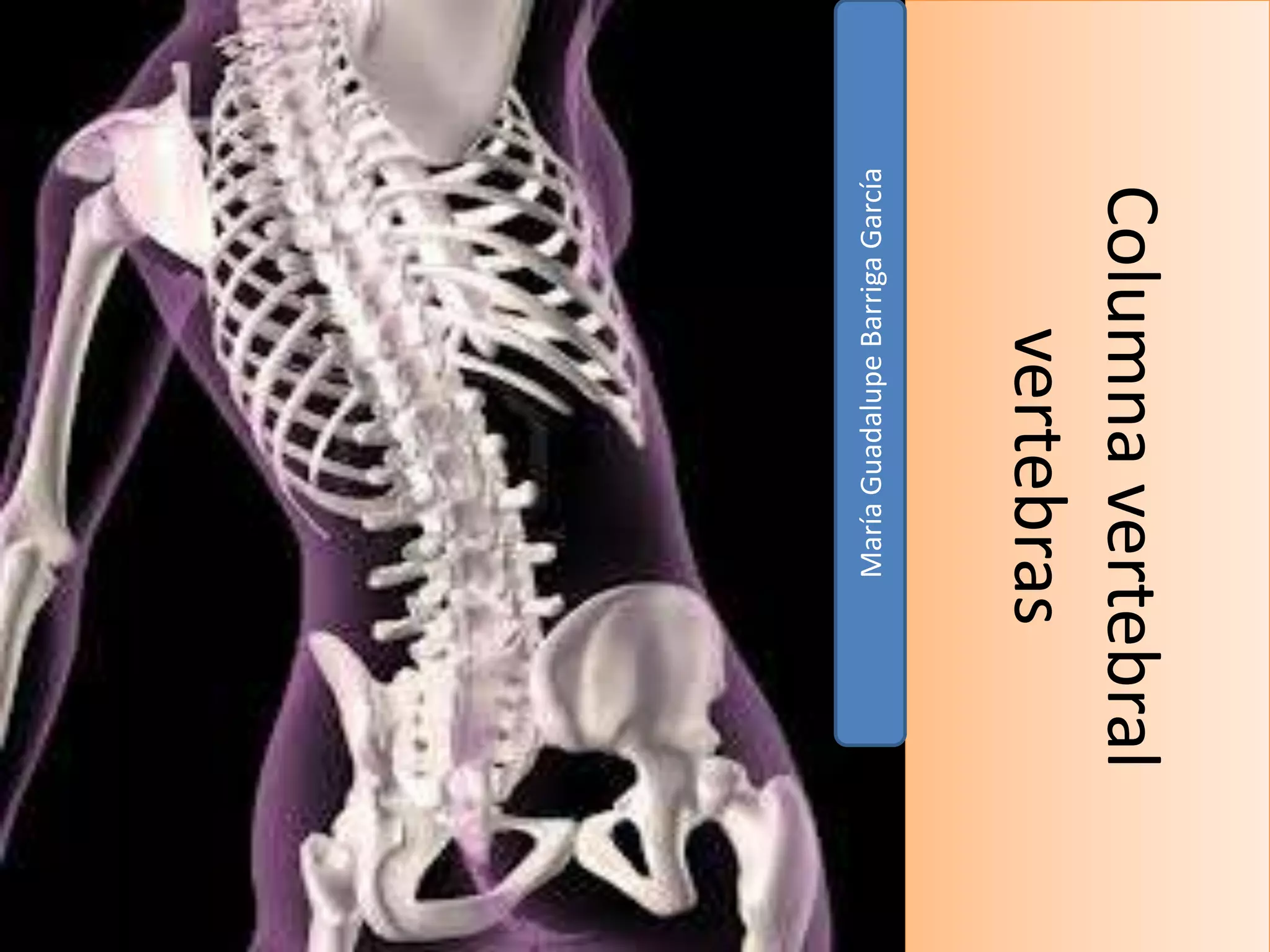 Columna vertebral. | PPT