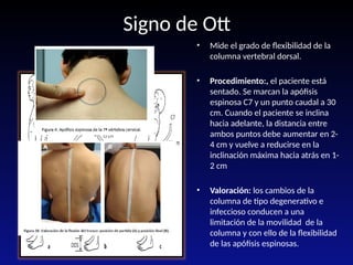 Semiología columna vertebral cervical dorsal y lumbar | PPTX