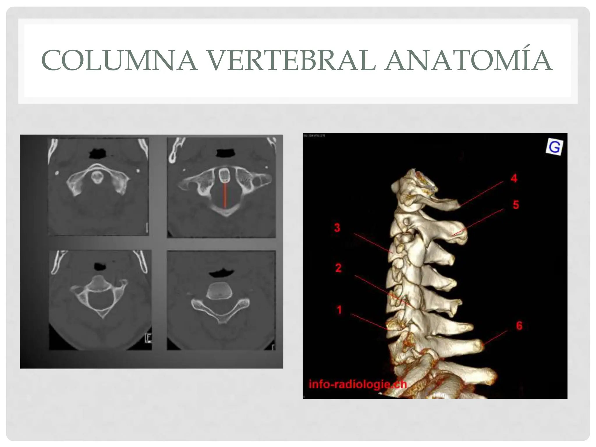 Anatomia de la columna vertebral cervical, dorsal y lumbosacra | PDF ...
