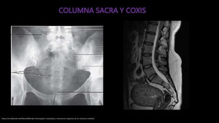 Columna vertebral, anatomia radiologica. .pptx