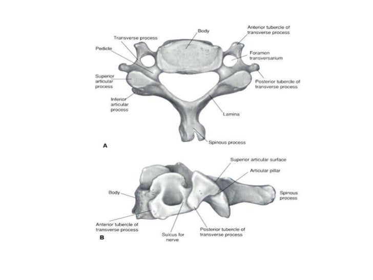 unciforme - définition - C'est quoi