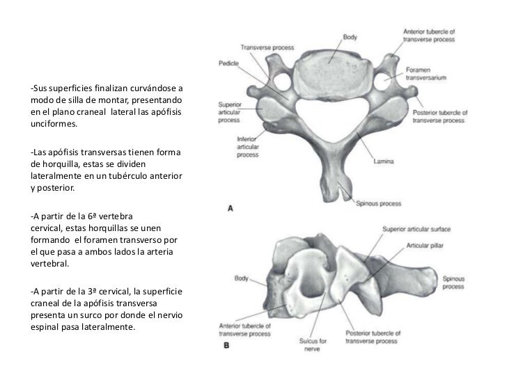 unciforme - définition - C'est quoi