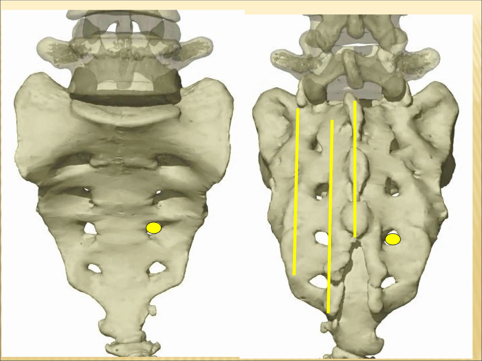 Anatomía de la Columna vertebral y Médula Espinal.ppt