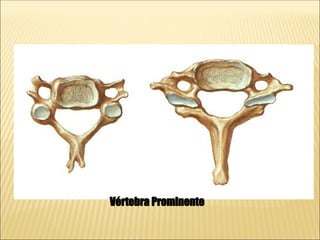 Anatomía de la Columna vertebral y Médula Espinal.ppt