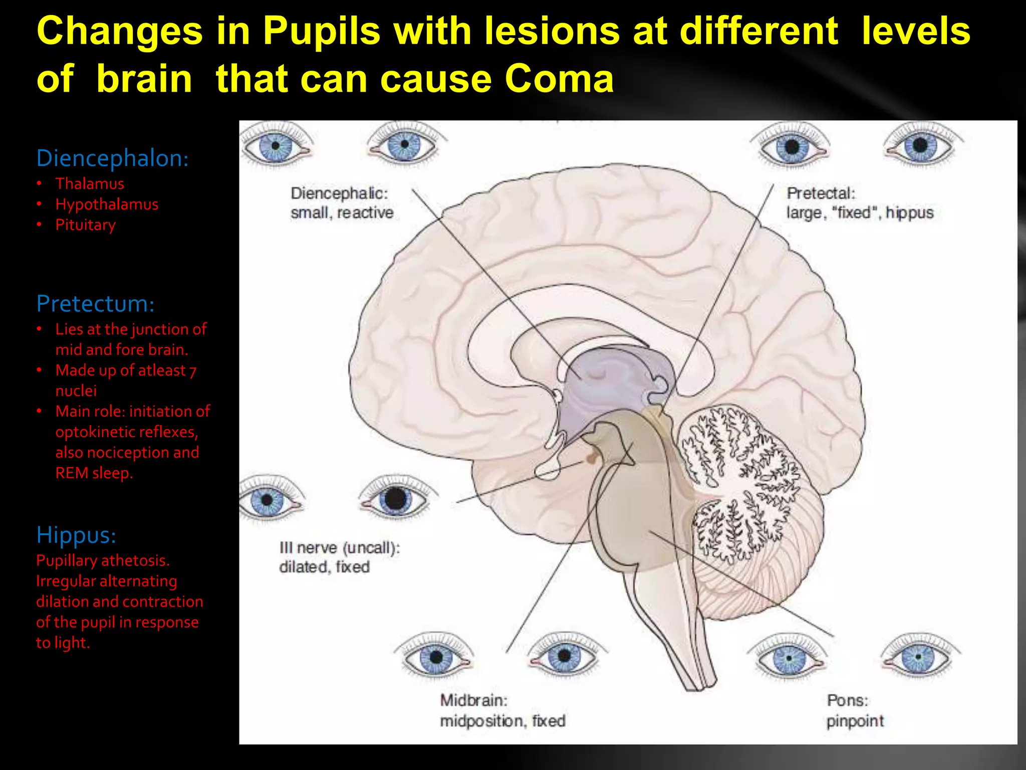 COMA | PPTX | Brain and Nervous System Disorders | Diseases and Conditions