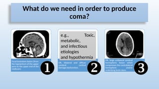 Coma and Brainstem Death, a lecture to undergraduate students | PPTX ...