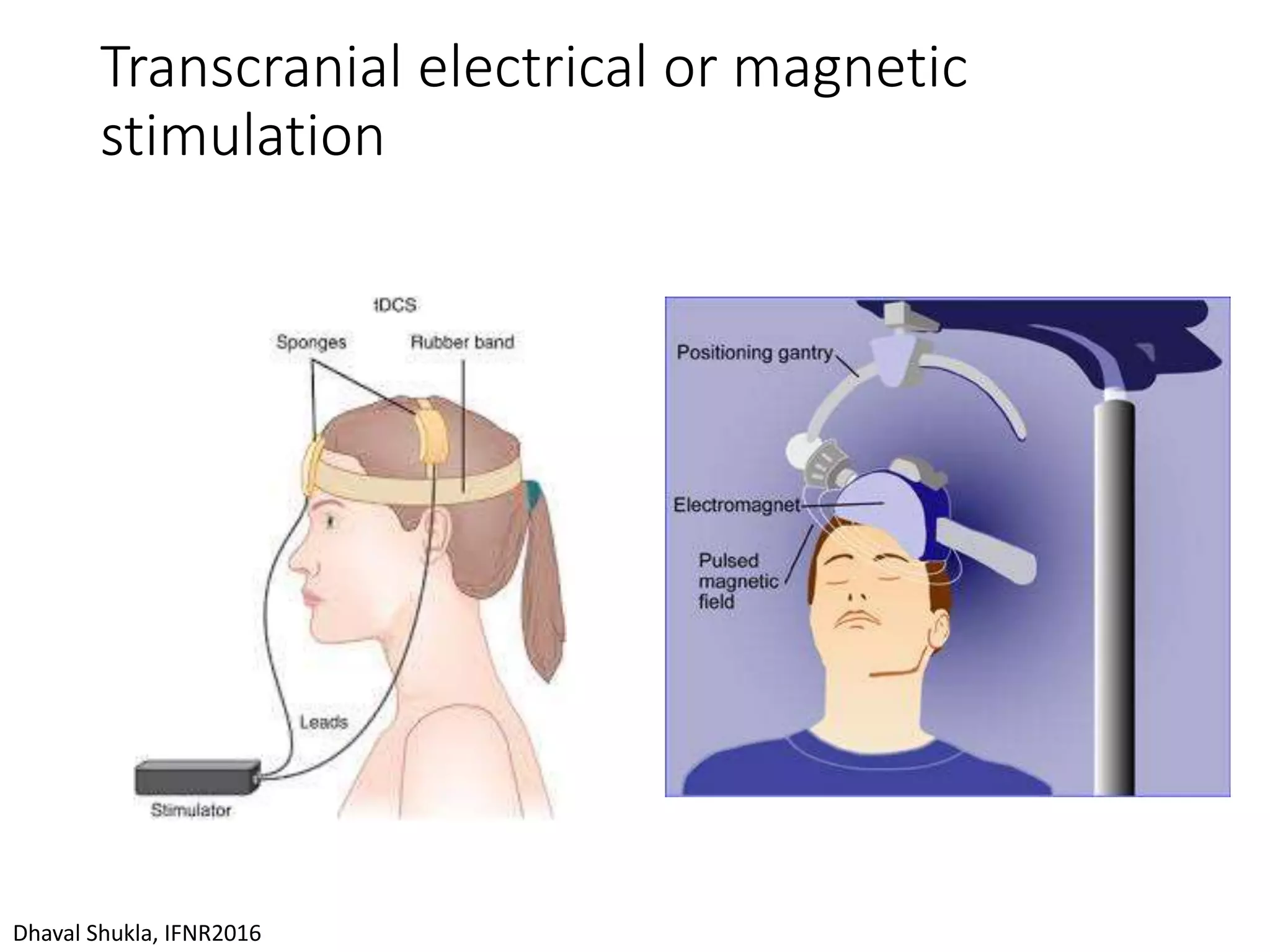 Coma Arousal Therapy | PPTX