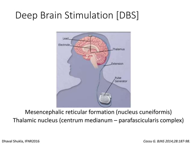 Coma Arousal Therapy | PPTX | Brain and Nervous System Disorders ...