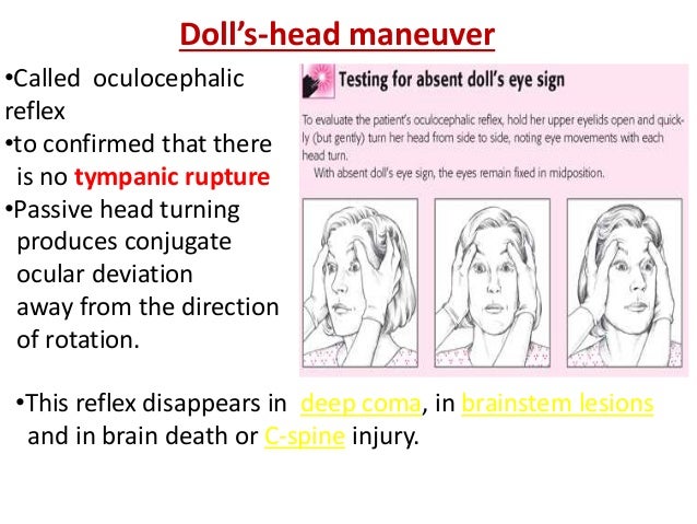 Coma Clinical Examination