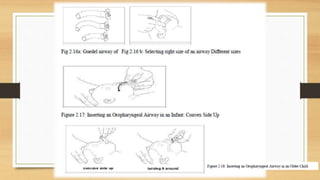 Coma & convulsion | PPT