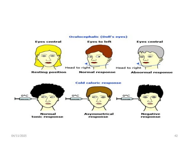 Diagnostic approach to comatose child .pptx