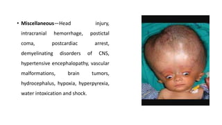 Coma in child | PPTX