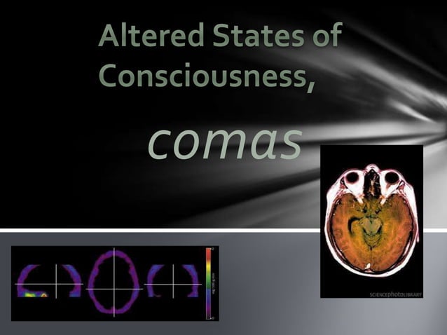 Comas | PPT