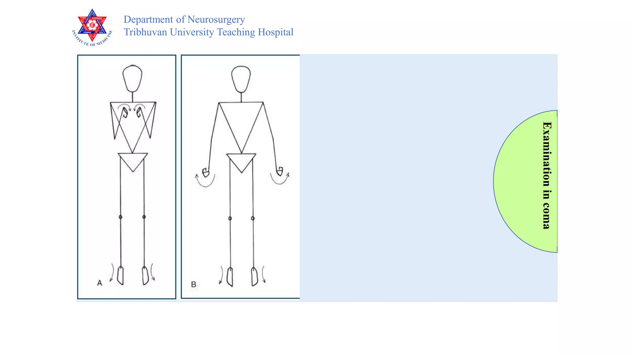 Coma, vegetative and locked in syndrome | PPTX