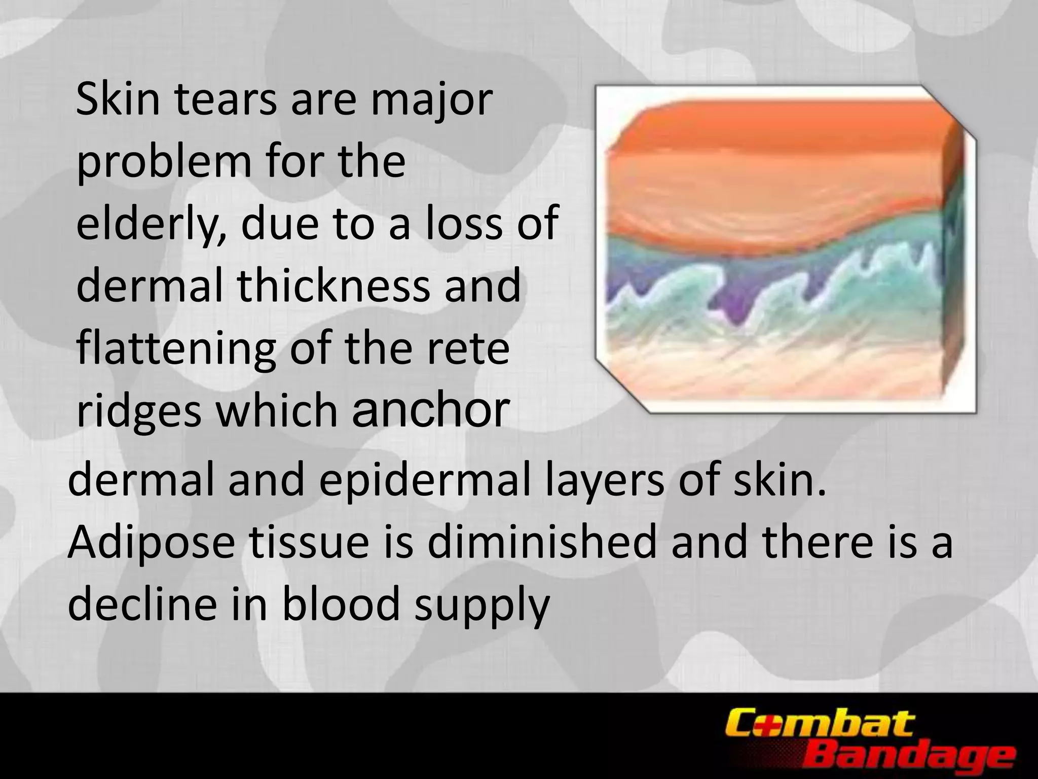 Combatbandage | PPSX