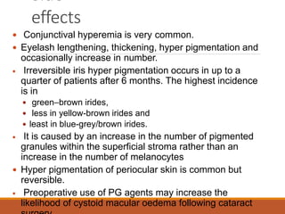 Combination medication glaucoma | PPT