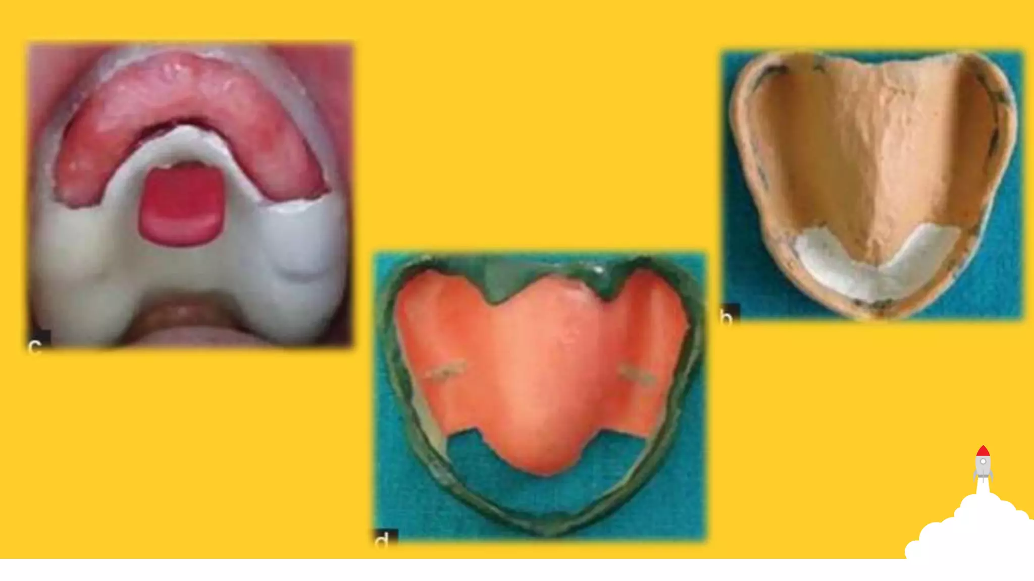 Combination syndrome | PPTX