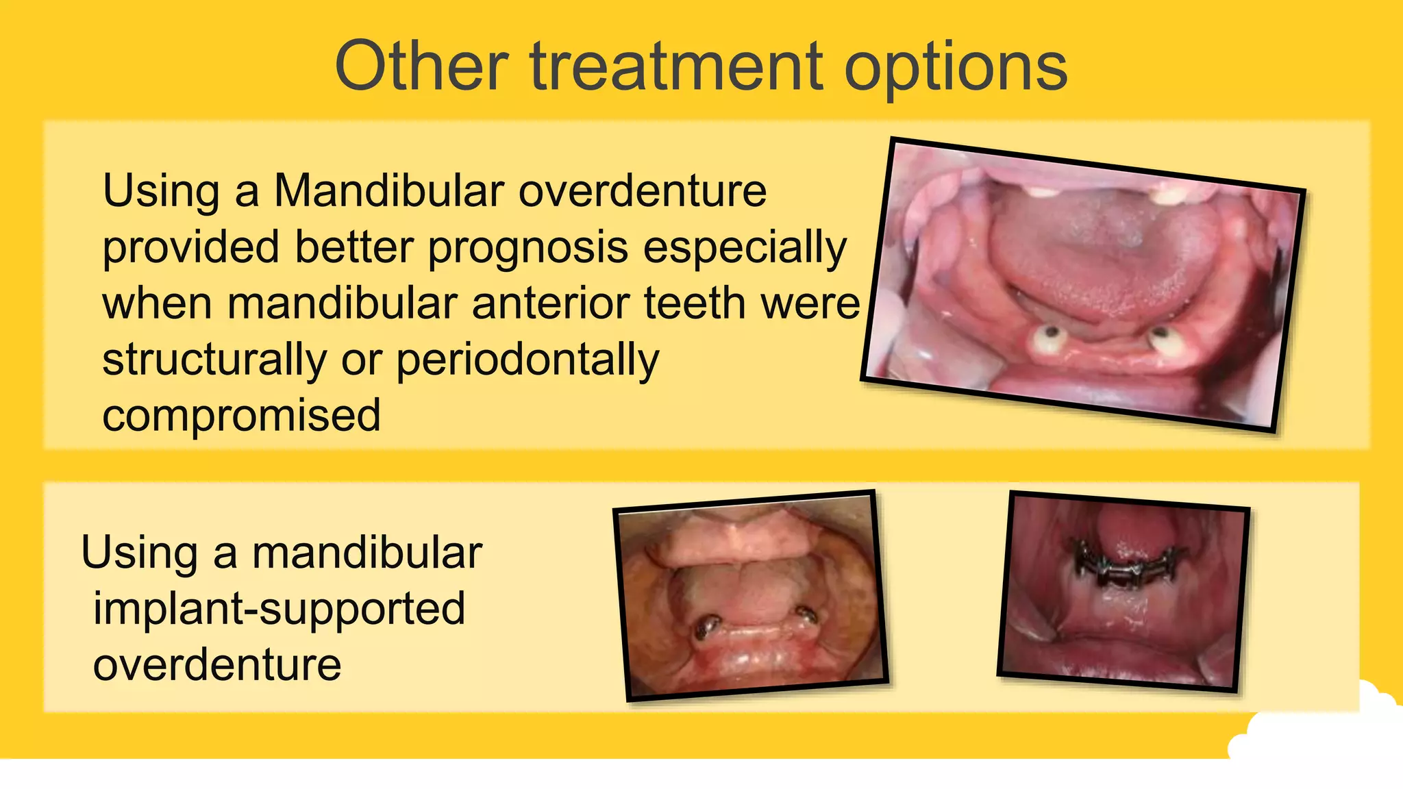 Combination syndrome | PPTX